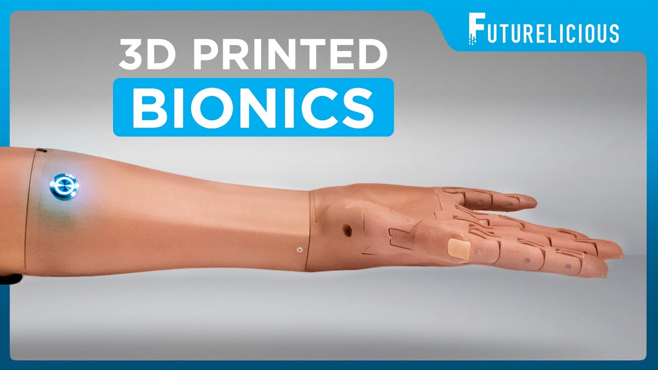 How 3D Printed Bionics are Changing Prosthetics - YouTube