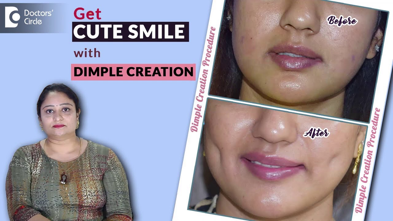 How to get dimple permanently?| Best Cosmetic Surgeon Bangalore-Dr ...