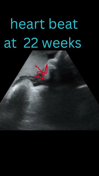 22 Weeks: Baby's Heartbeat Magic 💓#heartbeat #22weekspregnant #baby # ...