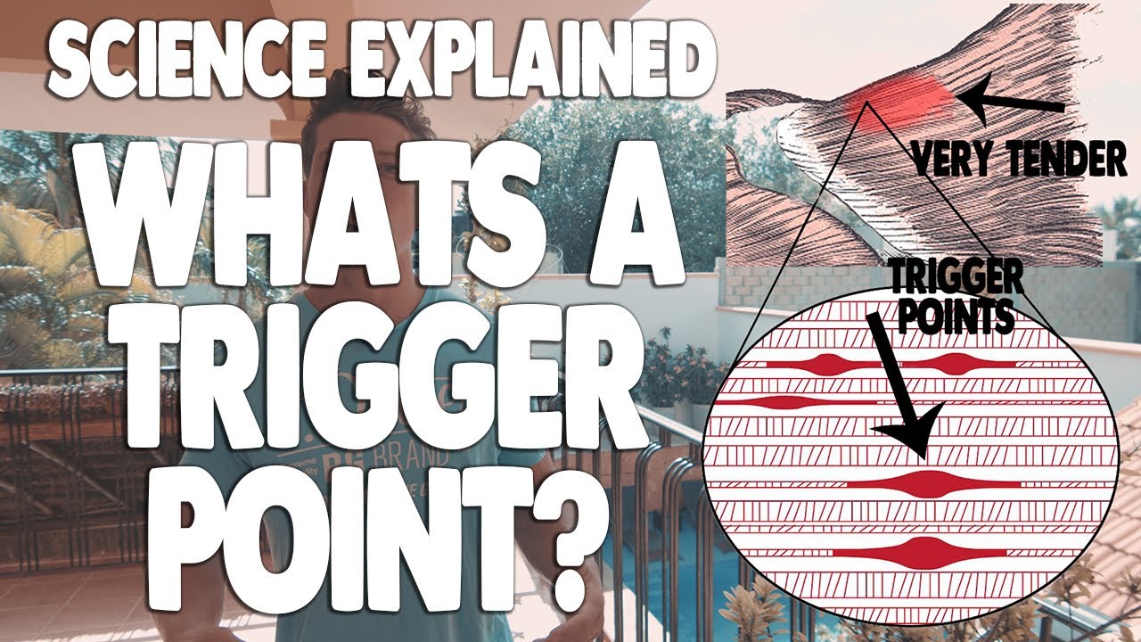 What Is A Trigger Point | Science Explained - YouTube