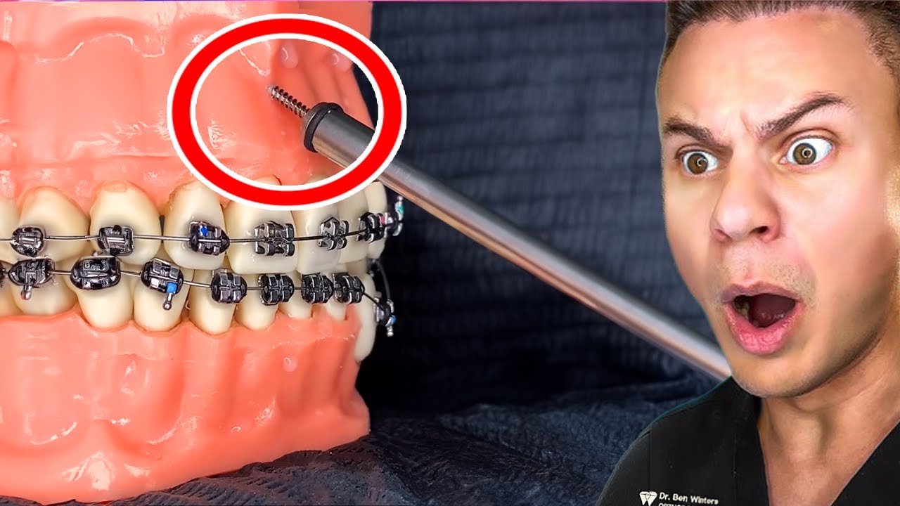 The SCARIEST Dentist Device You Will Ever See! - YouTube