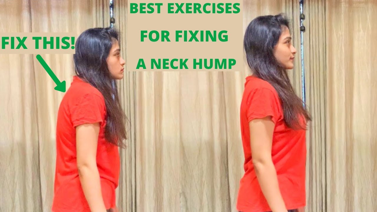 Quick 4 Minute Fix For Neck Hump | 2 Easy Exercises To Fix Rounded ...