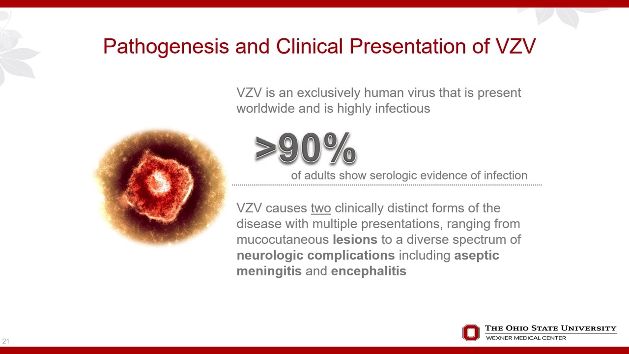 Detection of VZV & HSV in Skin & CNS Infections Using Molecular Testing ...