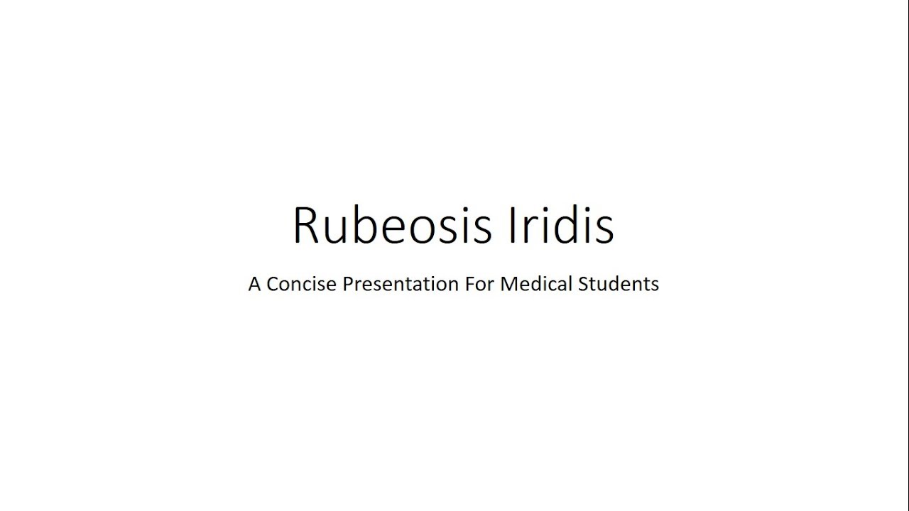 Rubeosis Iridis / Neovascularisation of Iris (NVI) - For Medical ...