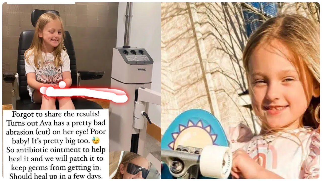 ‘OutDaughtered’ Ava Busby Ends Up With Eye Injury, Is She Ok? - YouTube