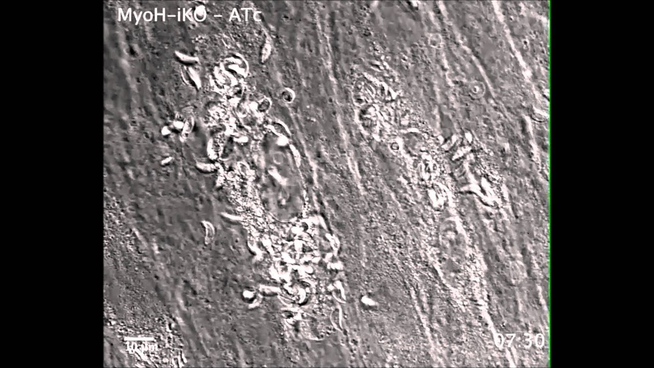 The Conoid Associated Motor MyoH Is Indispensable for Toxoplasma gondii ...