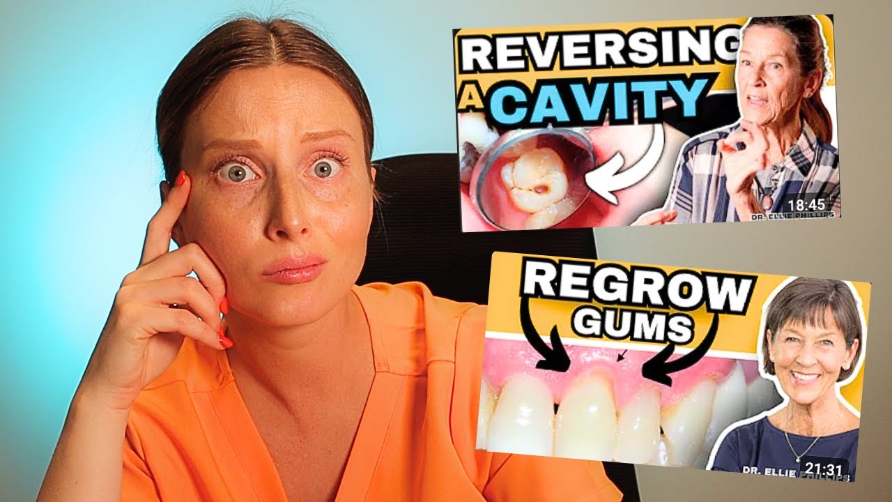 Dr. Ellie’s Oral Care Routine: Shocking Results After 2 Weeks! - YouTube