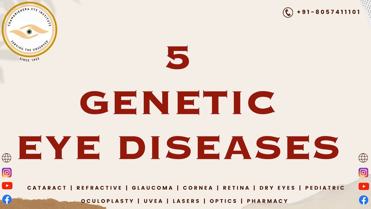 Can eye diseases be GENETICALLY INHERITED from your parents ...
