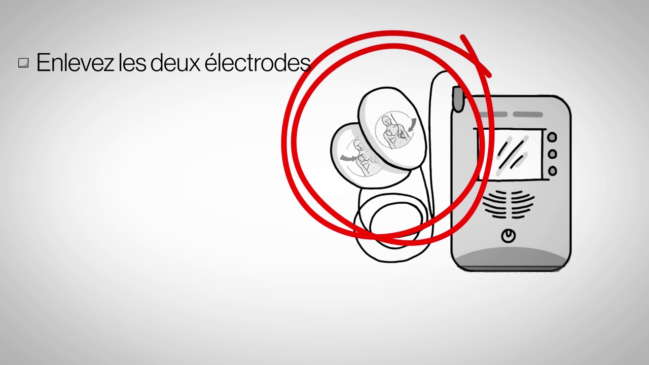 Apprenez à utiliser un DEA en moins de 90 secondes - YouTube