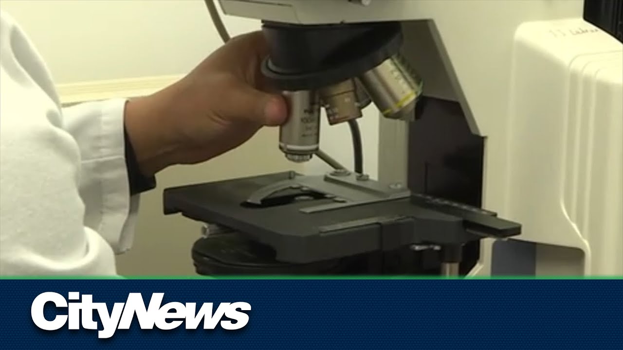 Dispelling the stigma around genetic eye conditions - YouTube