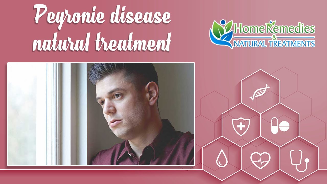 Peyronie's Disease: Home Remedey for Peyronie's Disease Cure| Peyronie ...