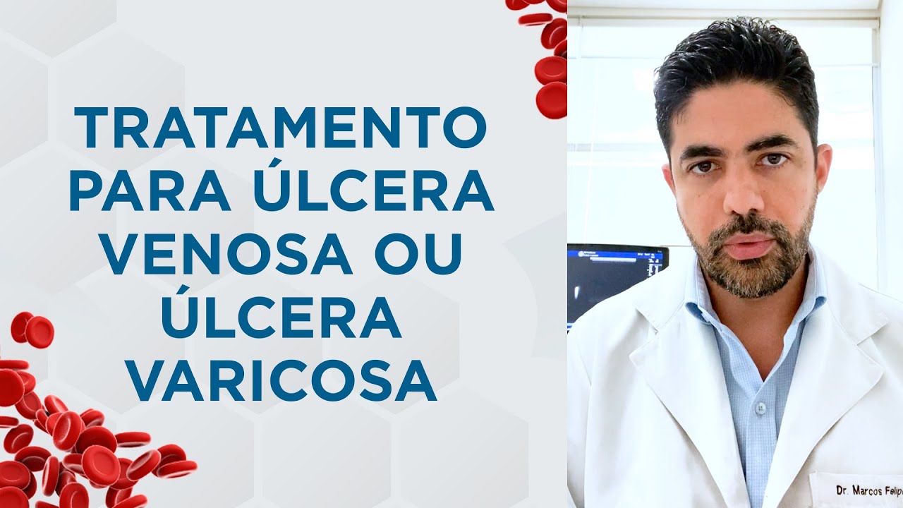 Tratamento para Úlcera Venosa ou Úlcera Varicosa | Dr. Marcos Magalhães ...