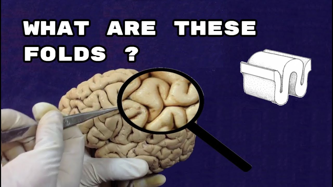 NeuroAnatomy - Brain Folds | Sulci and Gyri on Superolateral Surface of ...