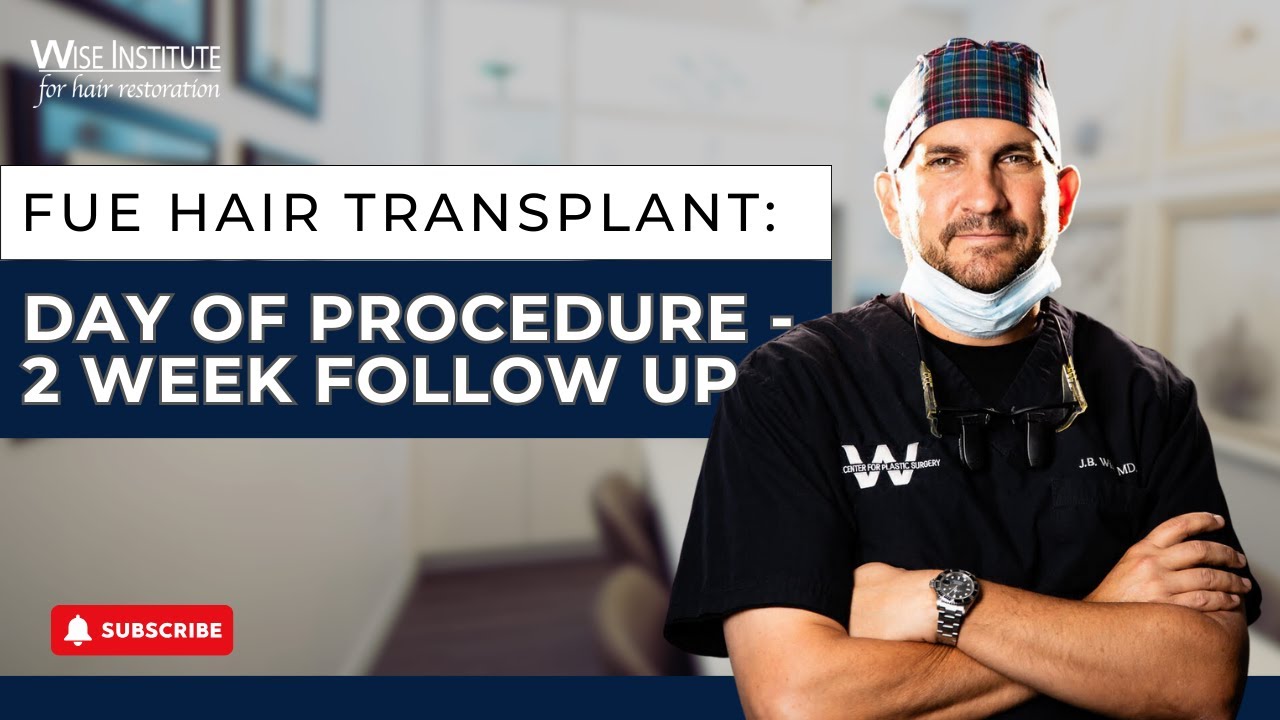 FUE Hair Transplant Journey: Day of Procedure to 2 Week Post-Op - YouTube