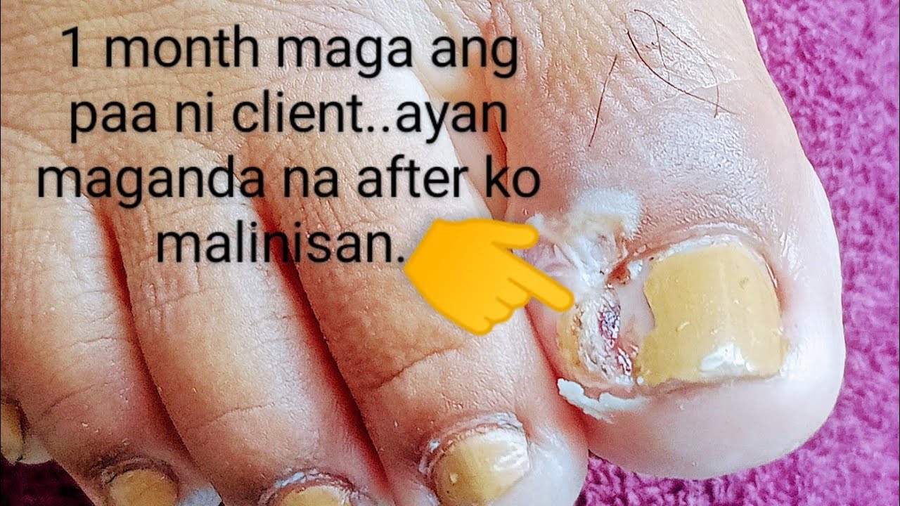friday blog...1month maga ang paa ni client..🇮🇹 ️ - YouTube