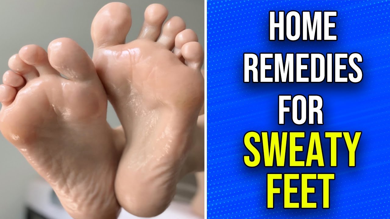 Home Remedies For Sweaty Feet - Hyperhhidrosis Treatment - YouTube