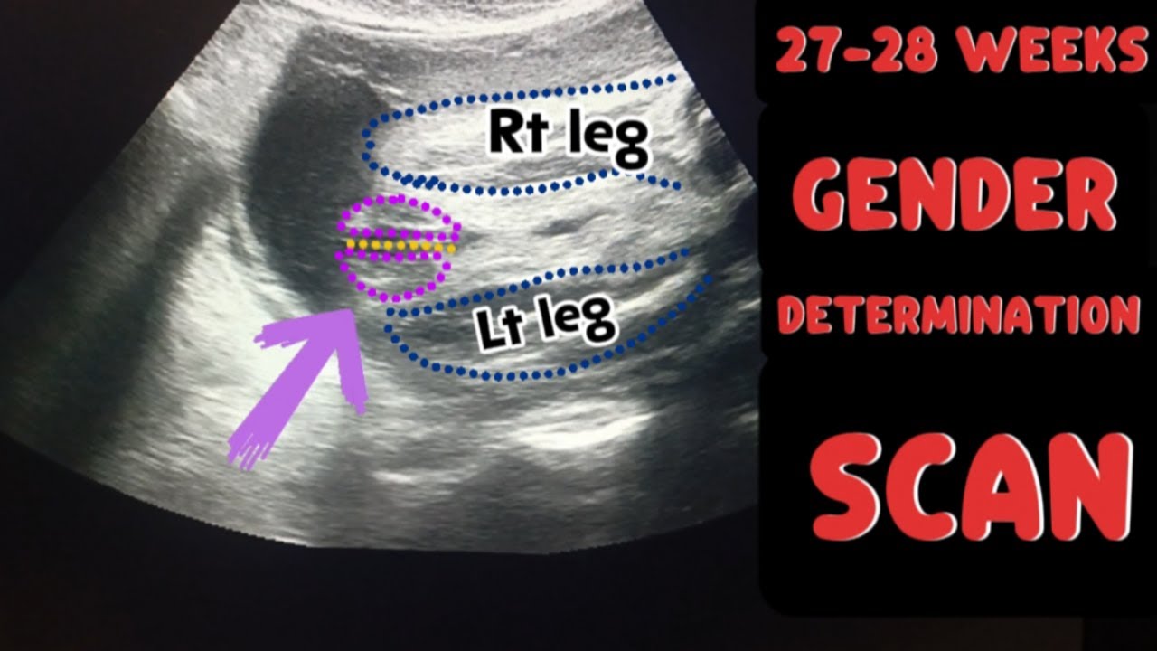 27-28 Weeks Gender Determination Scan - YouTube