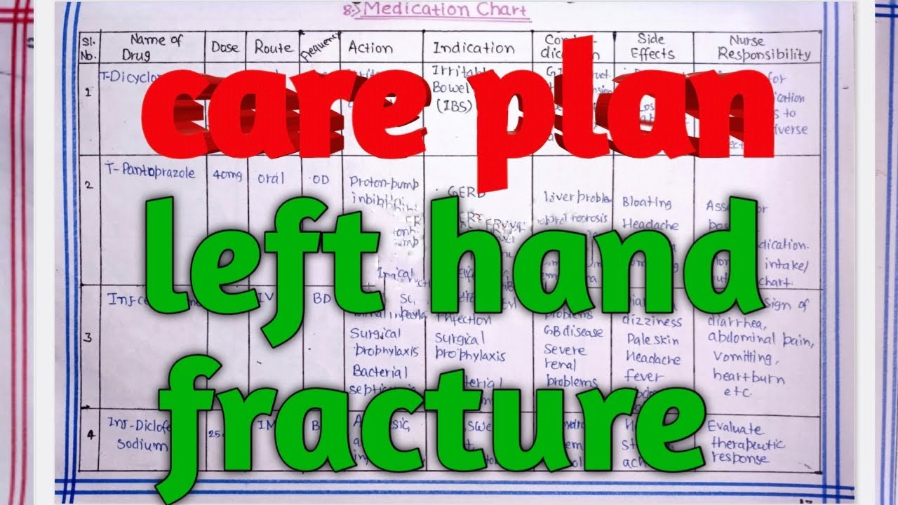 ncp for fracture of left radius bone ( left hand ) , nursing care plan ...
