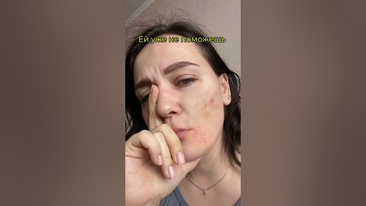 Бедолага 🫠Главное найти своё средствое. Сыворотка с ниацинамидом от ...