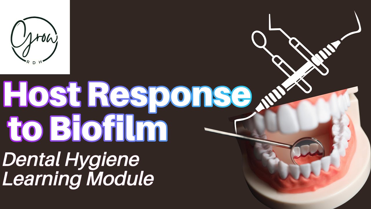Periodontal Disease Host Response to Oral Biofilm - YouTube