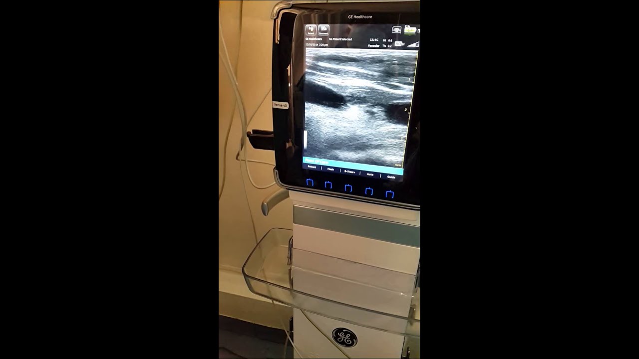 IJV Cannulation USG Guided In Plane - YouTube