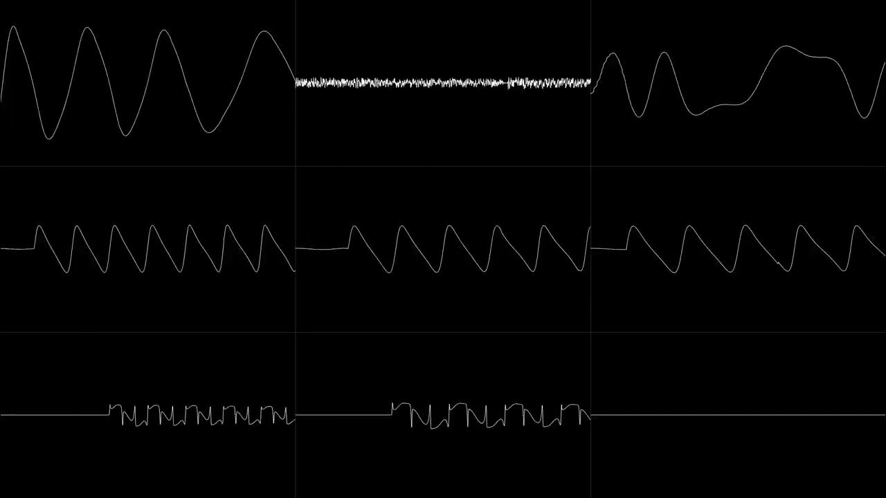 [Redo] Yuzo Koshiro - Fighting In The Streets (YM3526) - YouTube