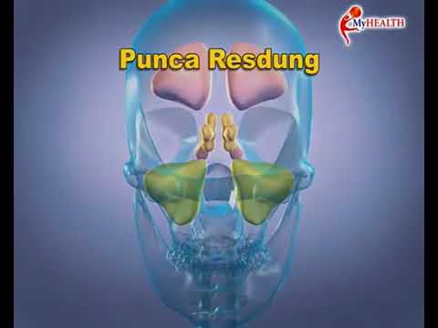 Bagaimana Resdung Terjadi - YouTube