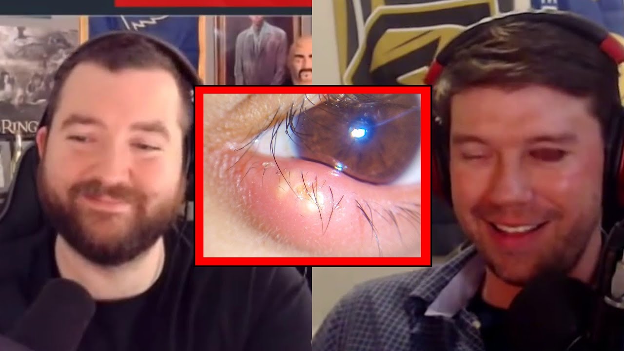 FPSRussia's Eye Cancer Surgery | PKA - YouTube