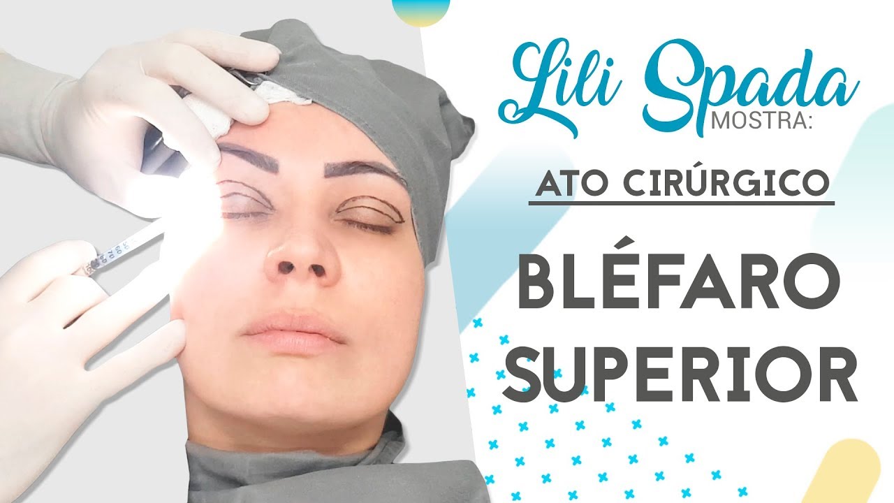 PROCEDIMENTO DE BLÉFARO SUPERIOR | LILI SPADA - YouTube