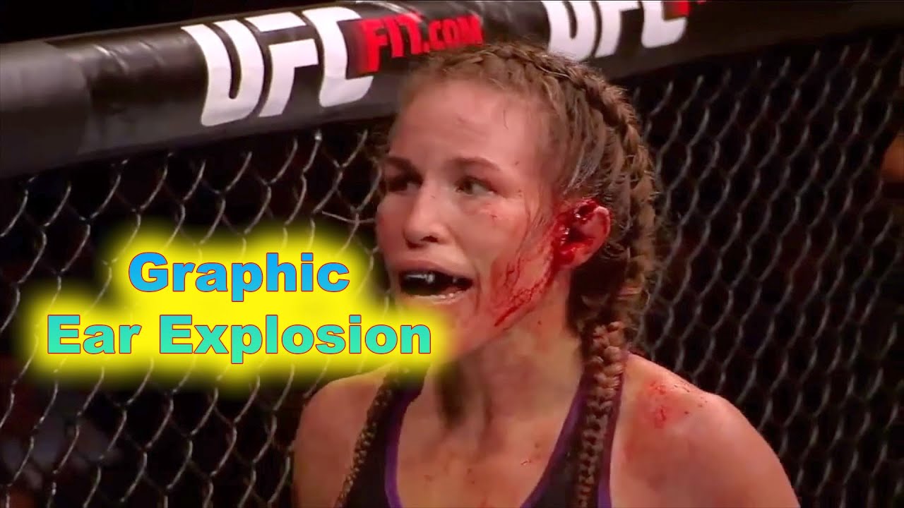 Gruesome Ear Explosion ( UFC fighter's cauliflower ear explode after ...