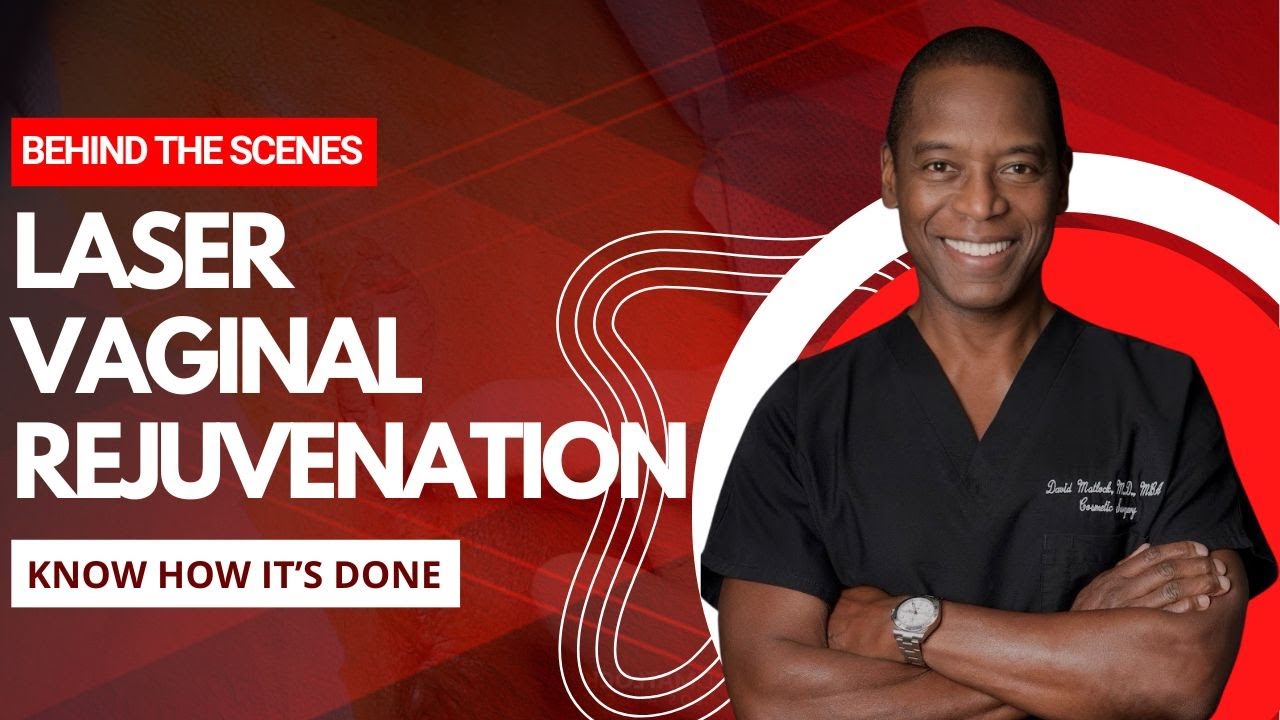 LASER VAGINAL REJUVENATION | FULL PROCEDURE IN 20 MINS | DR. DAVID ...