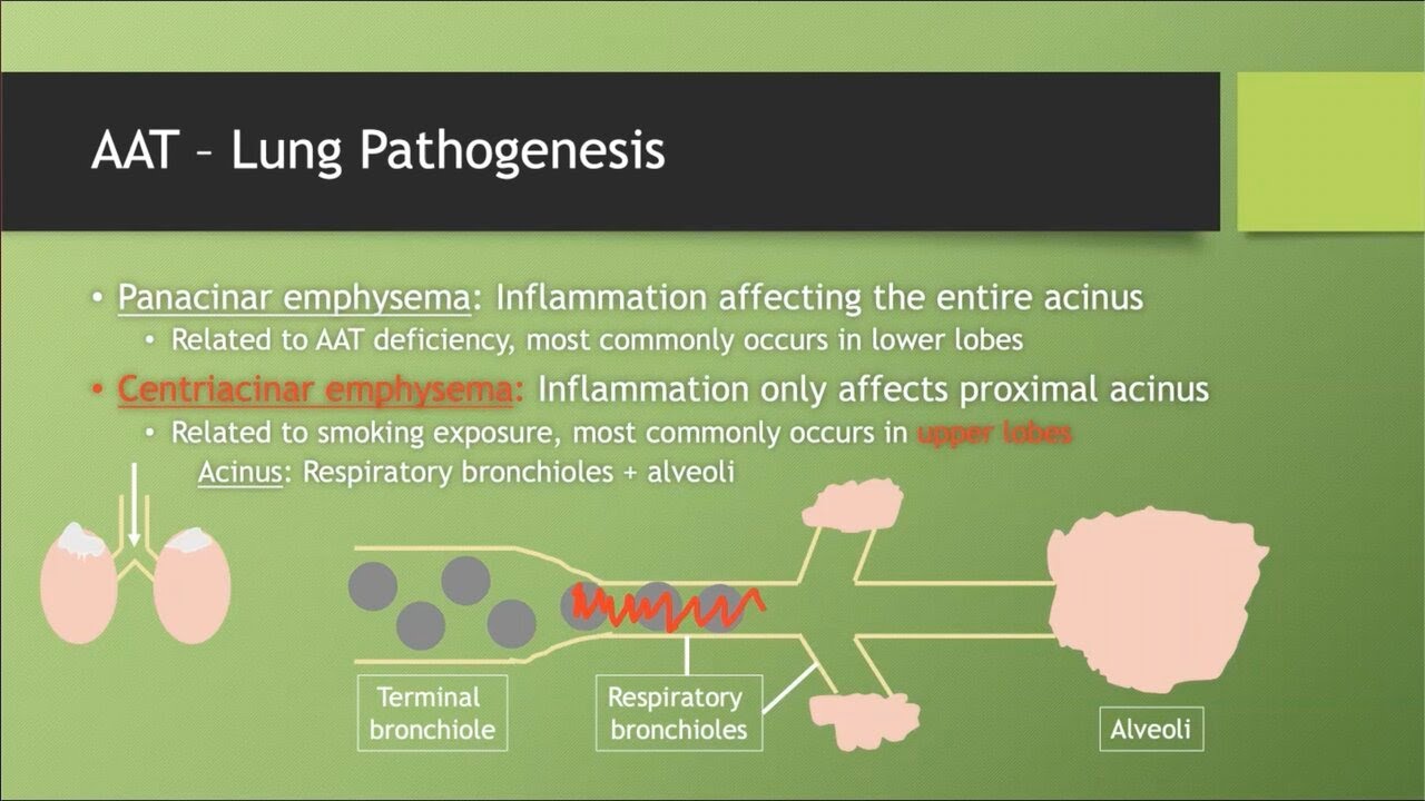 Alpha-1 Antitrypsin Deficiency - YouTube