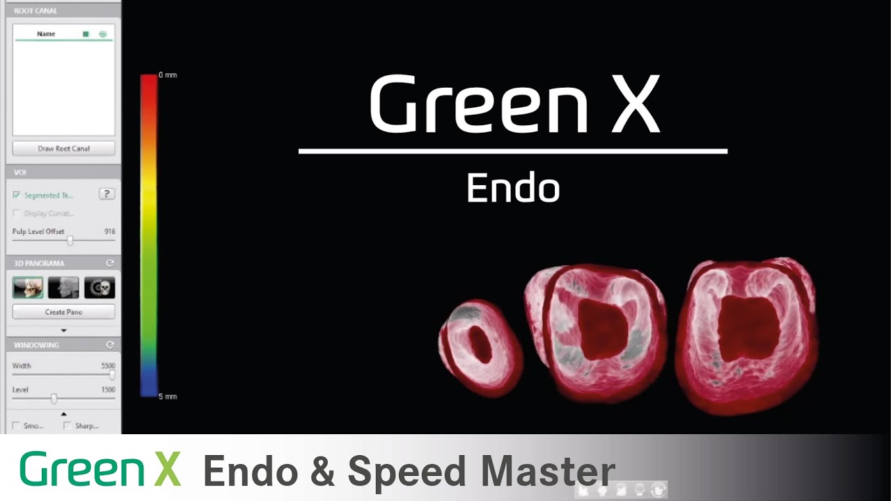 Das neue Green X Röntgengerät - YouTube