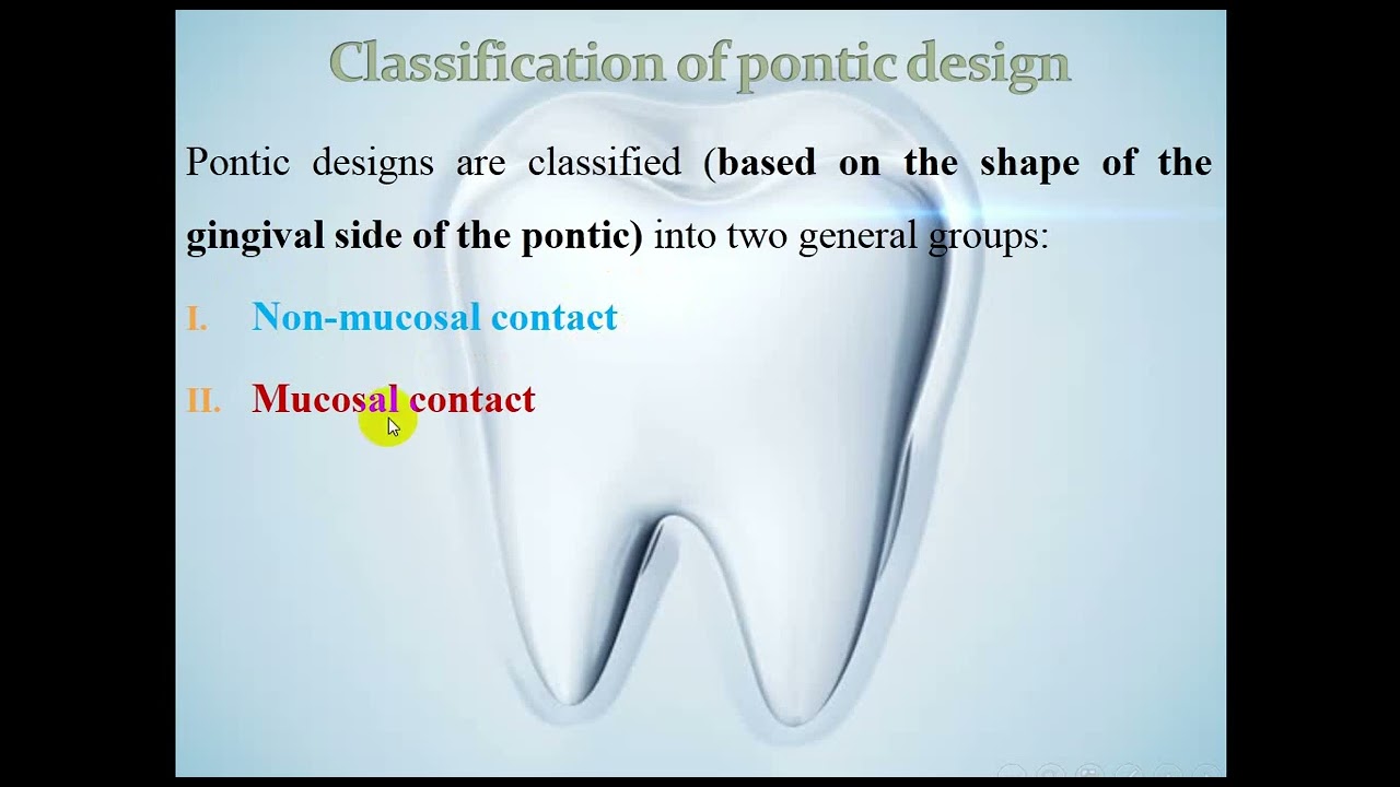 Pontics part 1 - YouTube