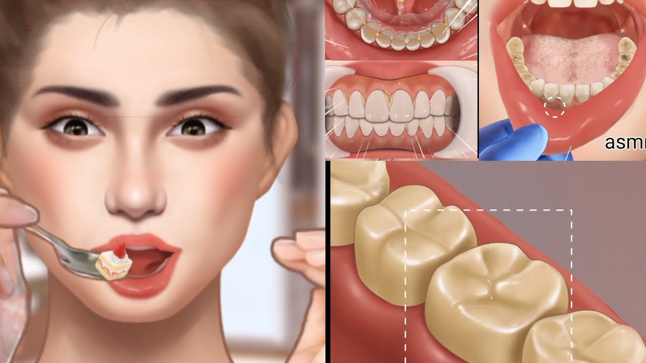 ASMR Treatment and removal , - YouTube