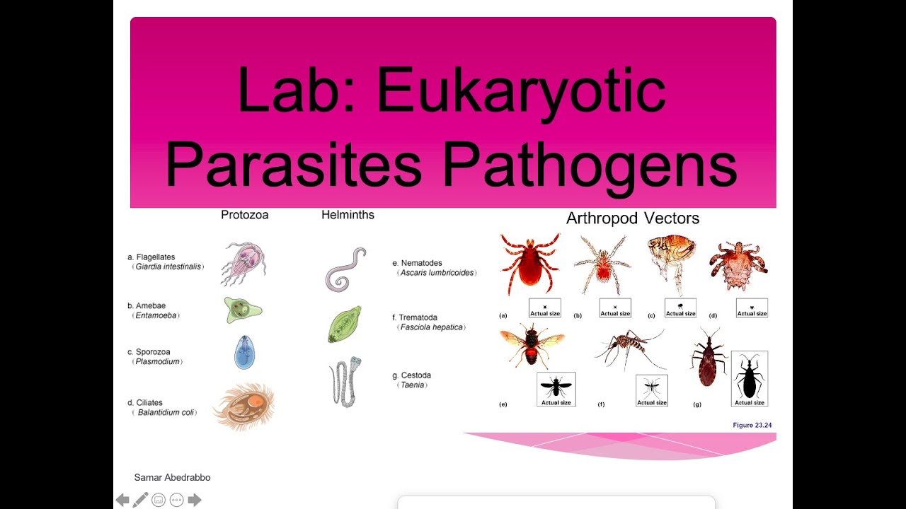 Eukaryotic Parasitic Pathogens Lab - YouTube