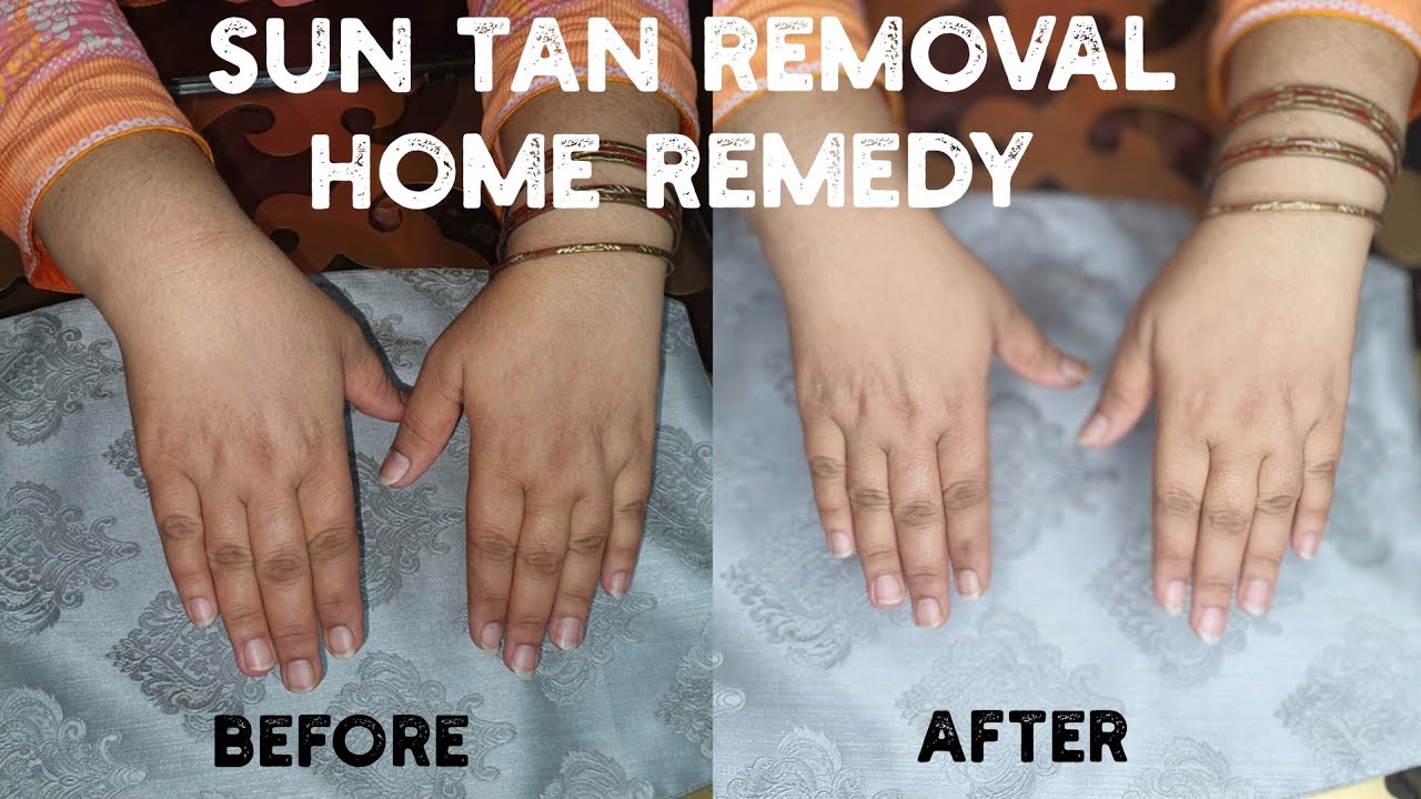 Remove Sun Taning/ No More Tan in Summers/ Glamour With Magic - YouTube