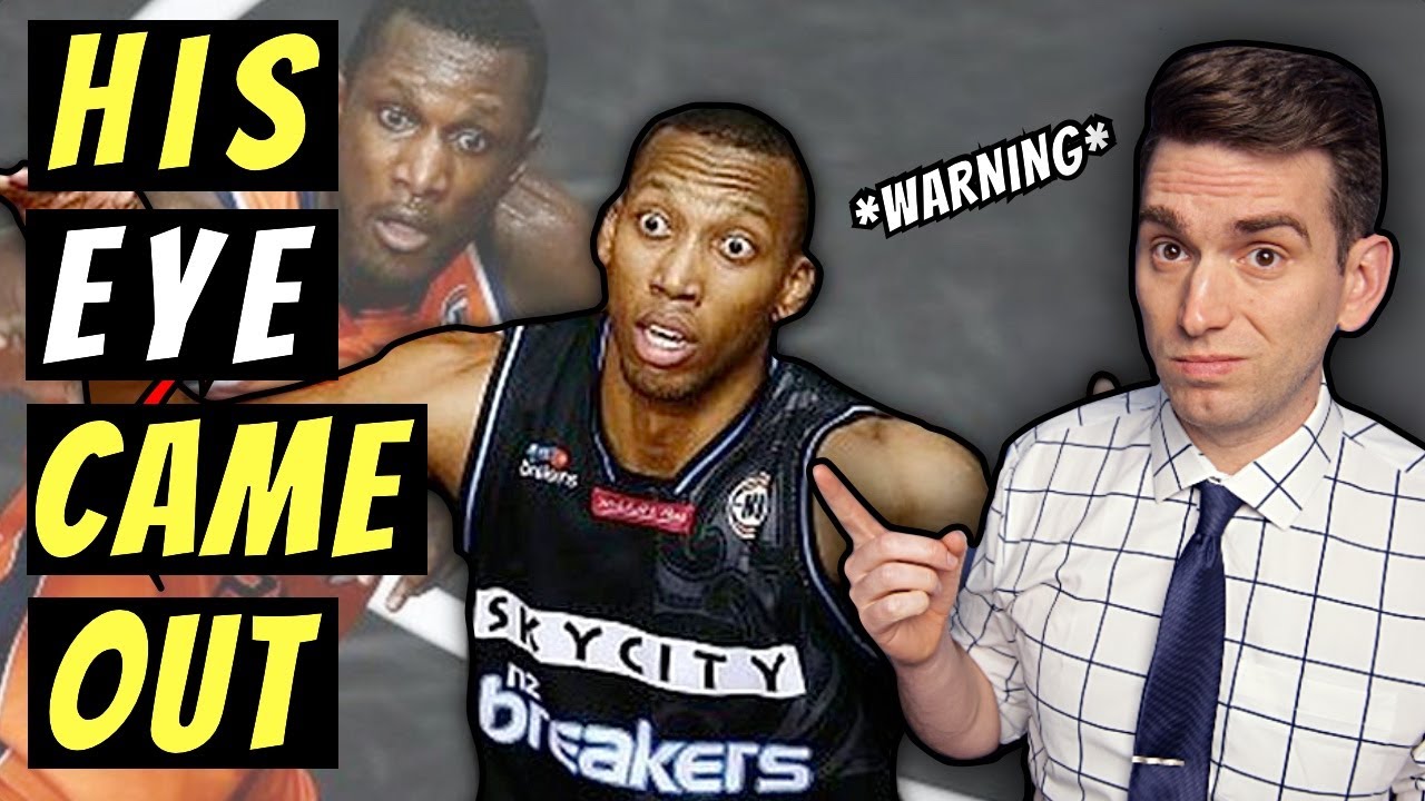 This May Never Happen Again On a Basketball Court - Doctor Explains ...
