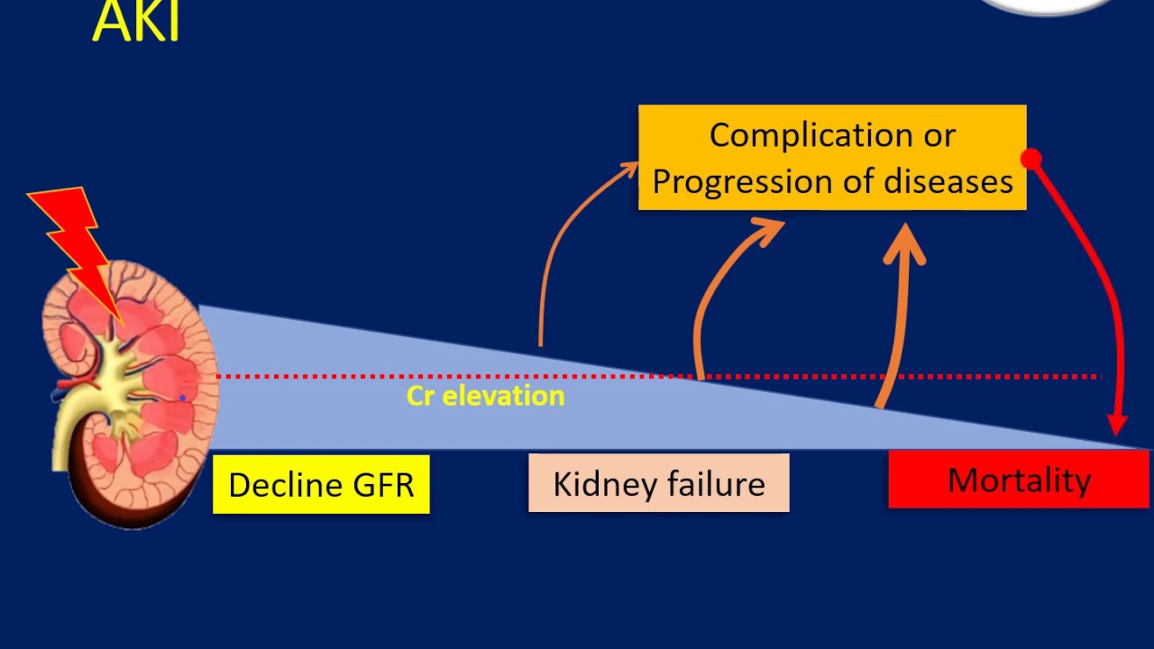 Acute Kidney Injury: Definition, Epidemiology and Etiology - YouTube