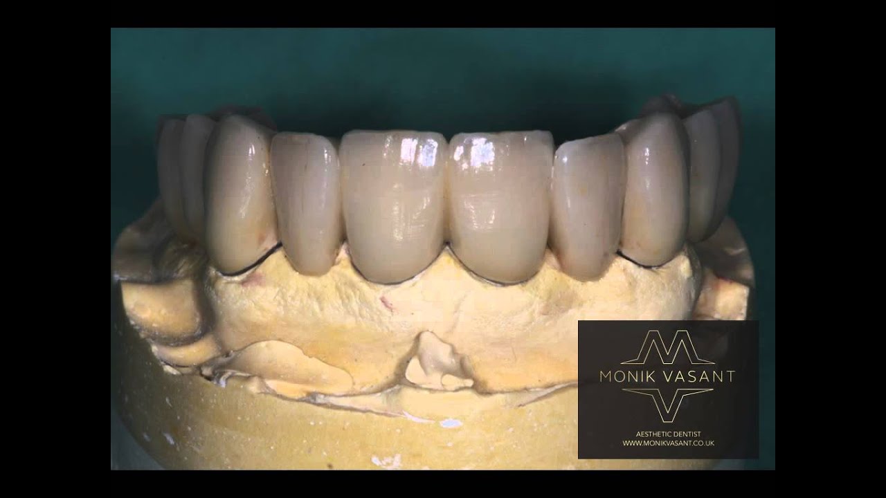 Telescopic bridges - YouTube