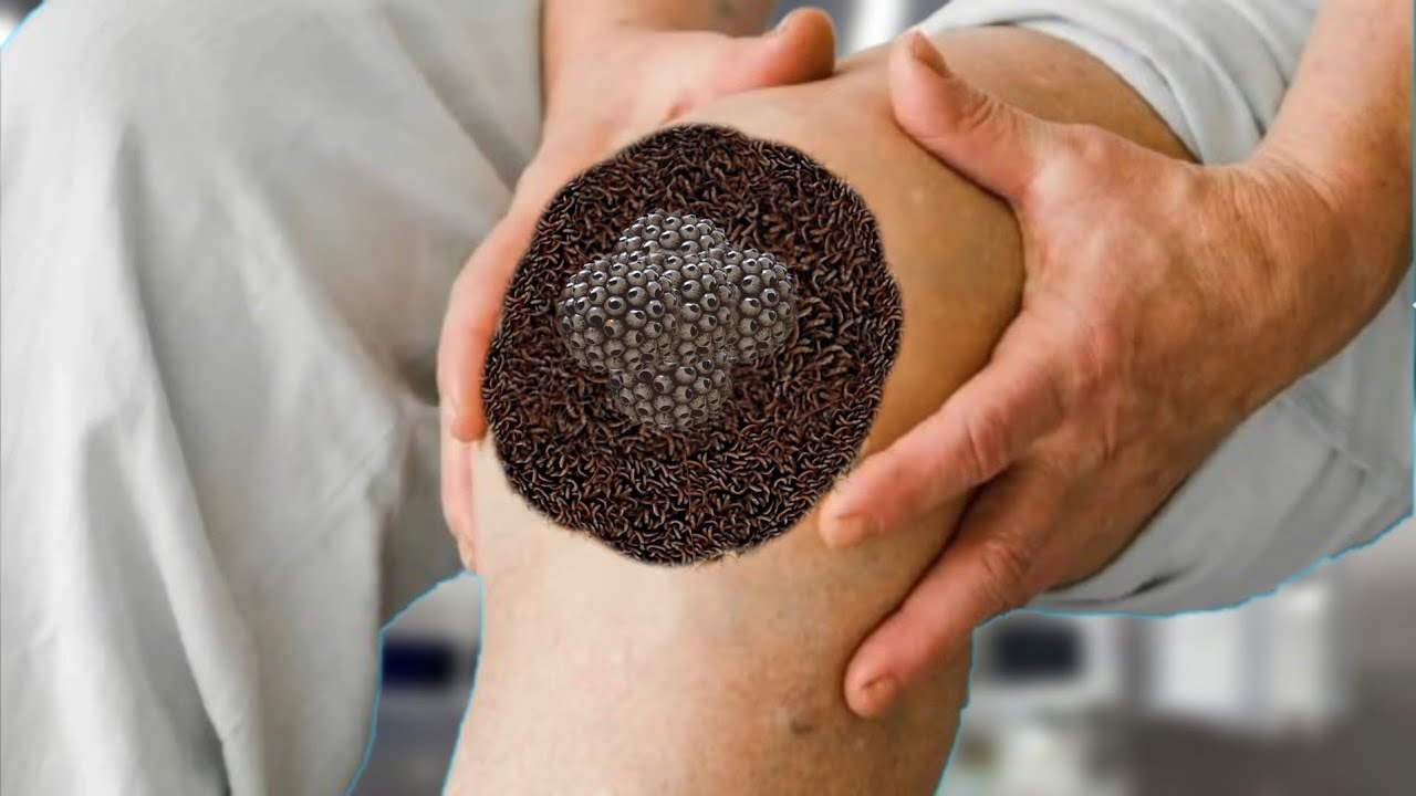 ASMR Leg Treatment|Tripophobia Defected Animation #asmr - YouTube