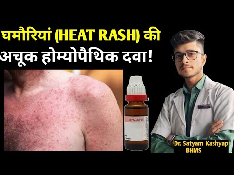 Ghamori ki Homeopathic Medicine | Heat rash Homeopathic Medicine - YouTube