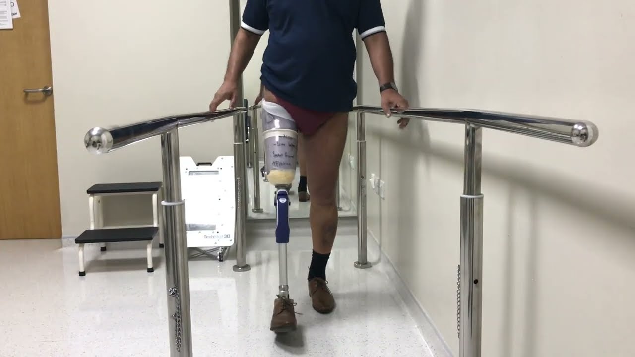 Trans femoral Amputee | above knee amputee walking with prosthetic leg ...