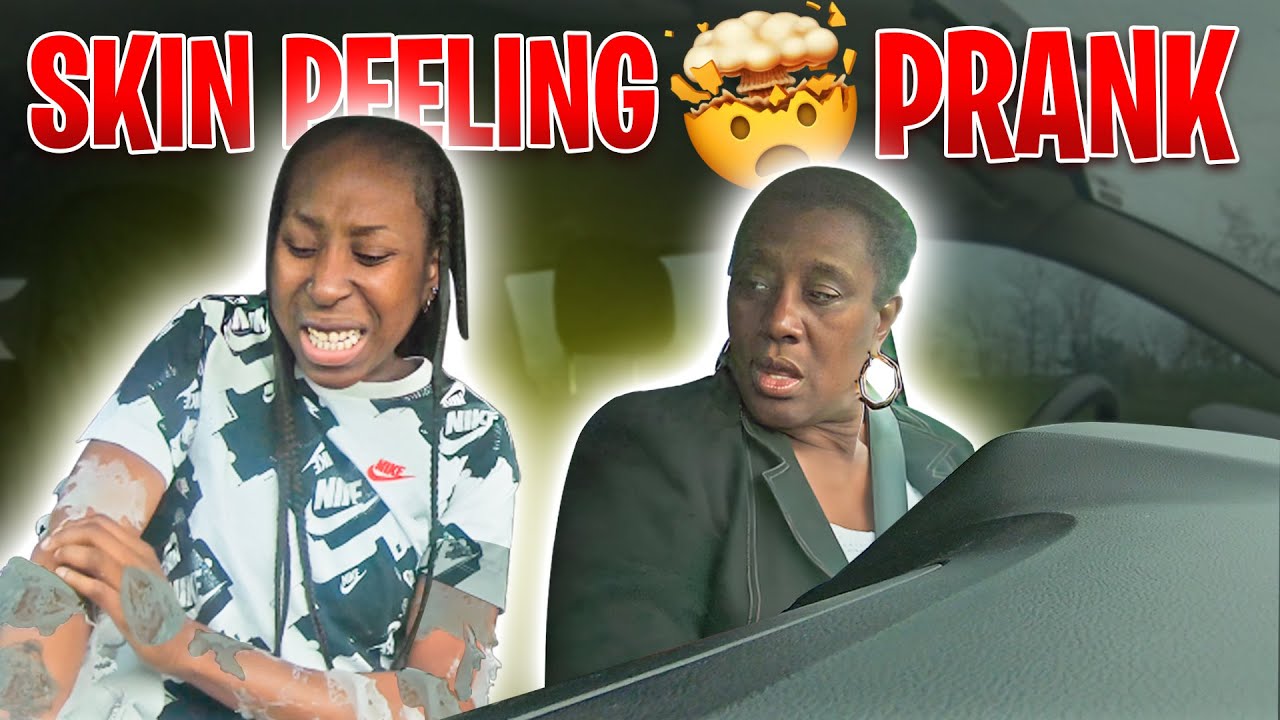 EXTREME SKIN PEEL PRANK ON JAMAICAN MOM - YouTube