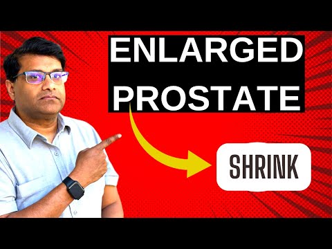 Does Kegel Exercise Shrink Prostate