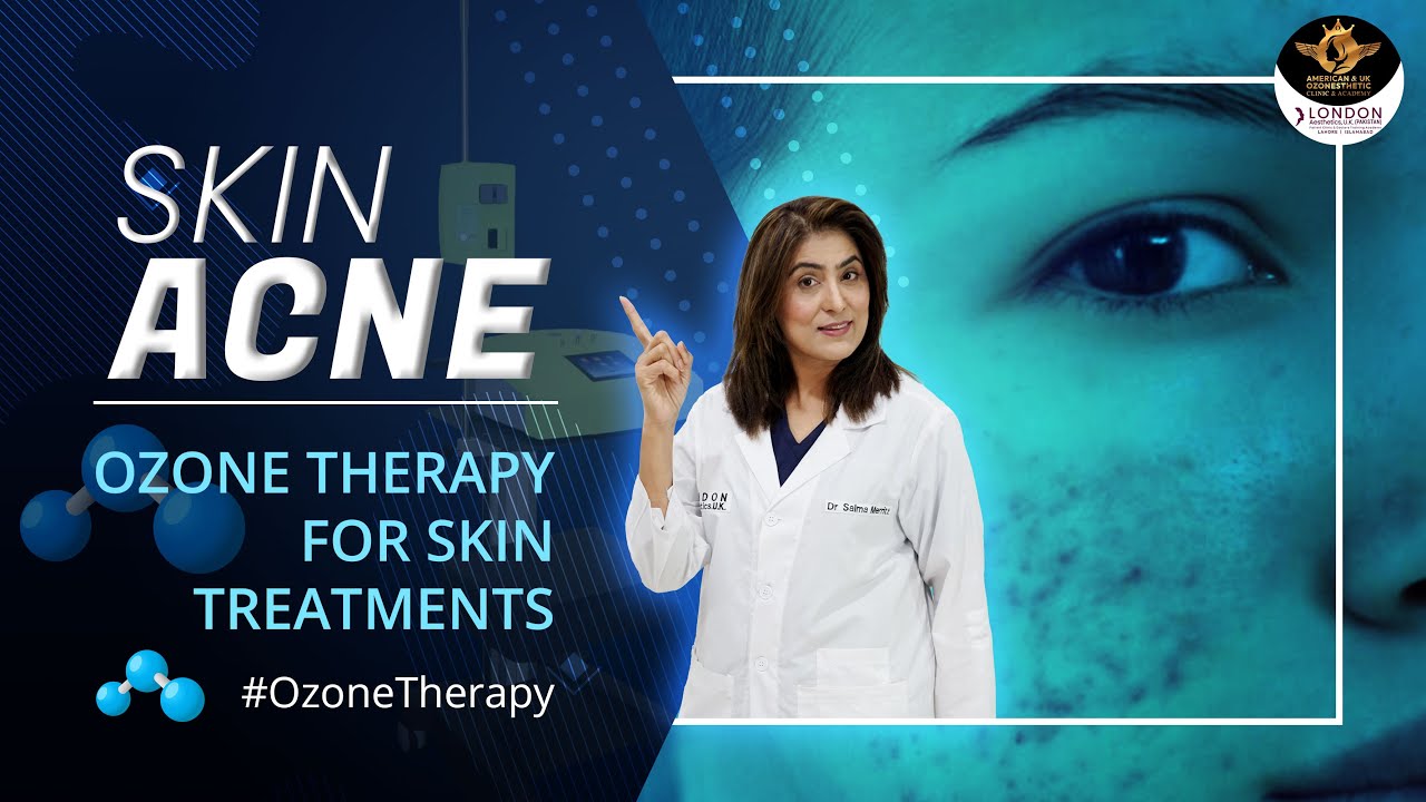 Skin Acne - Ozone Therapy for Acne Treatment, explained by Dr. Salma ...