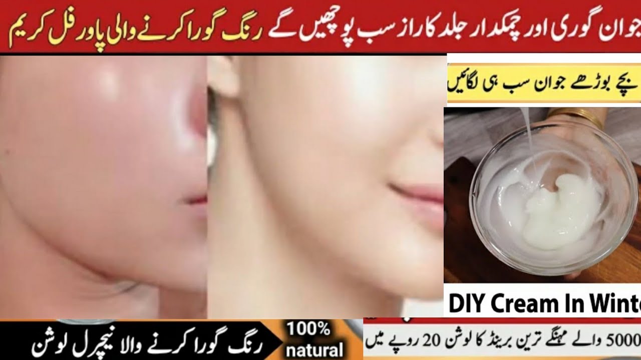 Homemade Skin Whitening Lotion | Hands Feet Whitening Diy | Selfcare ...