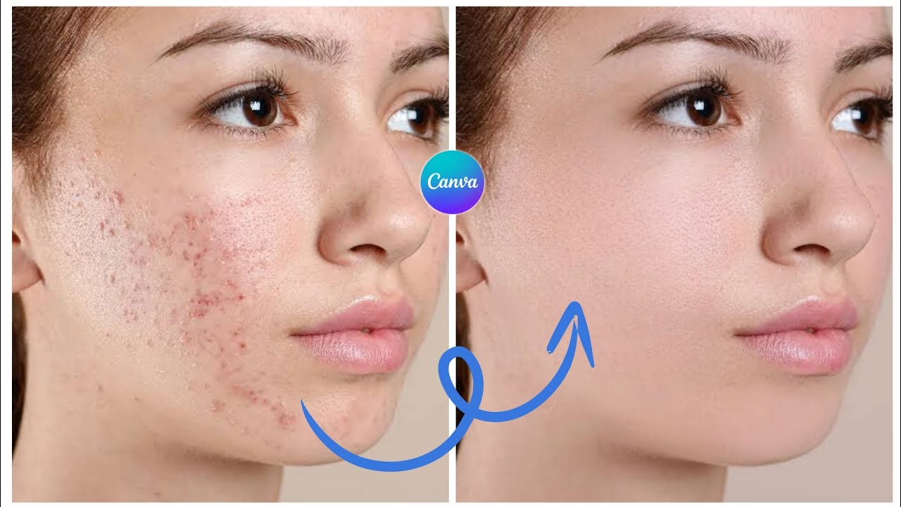 Face Retouching in Canva | Easy Photo Editing Tutorial - YouTube