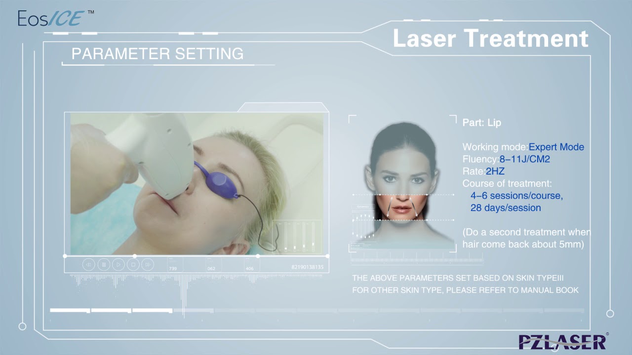 PZLASER Eosice hair removal - YouTube