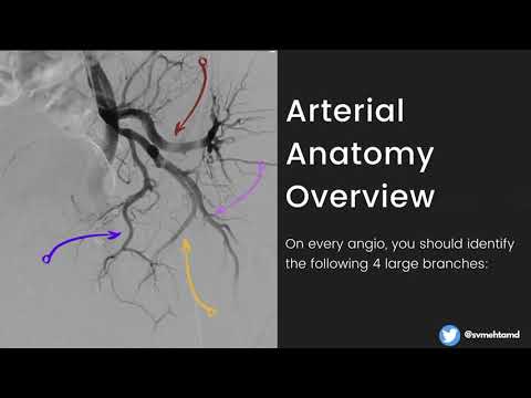 Prostate Artery Embolization: From Basics to Advanced